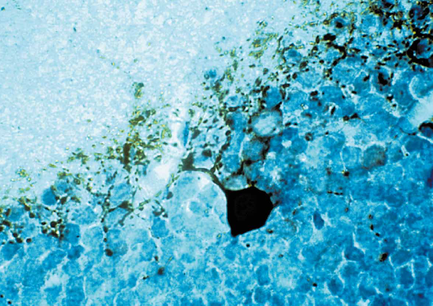 Neurodon 2025: "Inside the Brain: A Journey to the Center of Life", in ...